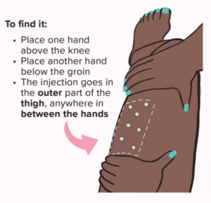How to give yourself an injection? A guide to subcutaneous and intramuscular injections. - Medbasic